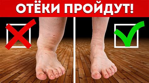 НОГИ больше не будут ОТЕКАТЬ! / ЭФФЕКТИВНОЕ лечение отеков ног - YouTube