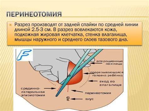 Швы саморассасывающиеся и синтетические, внутренние и внешние: как ...