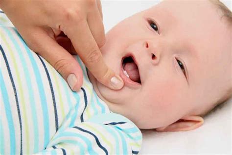 فلوراید وارنیش چیست؟ | مزایای فلوراید وارنیش | فلورایدتراپی دندان کودکان