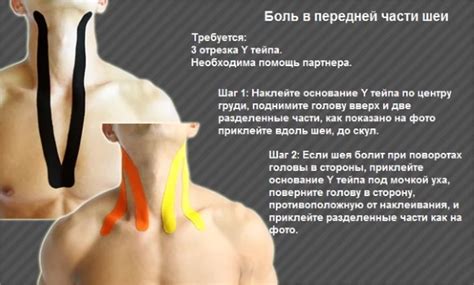 Тейпирование шеи от морщин, птоза. Что это такое, схема в домашних ...