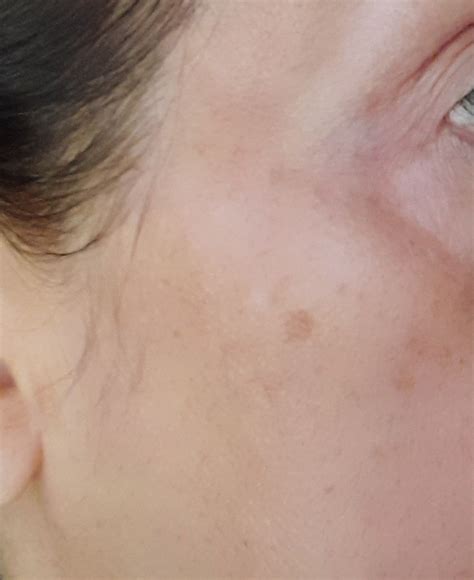 Matrixyl®️ Synthe’6®️ | Timeless Skin Care