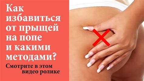 Прыщи на попе 5 ЭФФЕКТИВНЫХ методов от них избавиться! Смотрите в этом ...