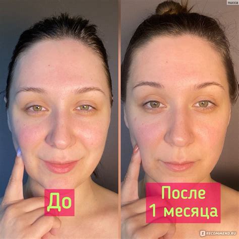 Гель для лица Selective Гельтек антикуперозный - «Тест геля на половине ...