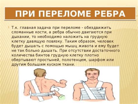 Наложение повязки при переломе ребра: как сделать корсет из бинта