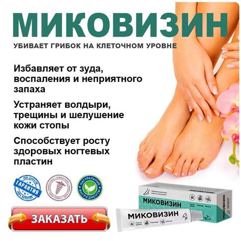 🧡МИКОВИЗИН от грибка. КУПИТЬ мазь, отзывы, цена в Израиле?