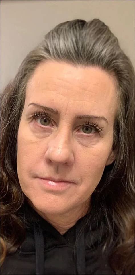 Frownies Facial Patches
