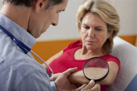 Васкулит: симптомы и методы лечения | MedAboutMe