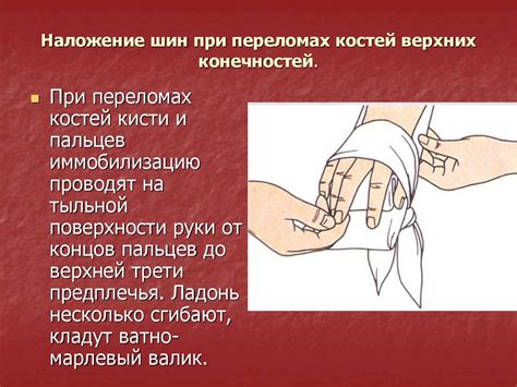 Правила оказания первой медицинской помощи при травмах опорно ...