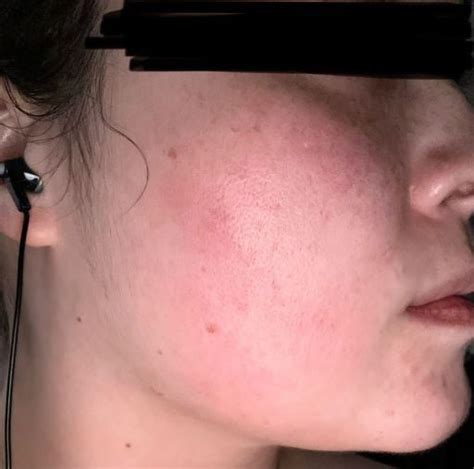 [Product Question] ANUA 77% Soothing Toner : r/SkincareAddiction