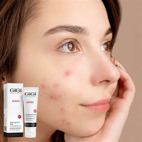 GIGI Acnon Pore Purifying Mask 50ml | KAUKĖ Prieš aknę