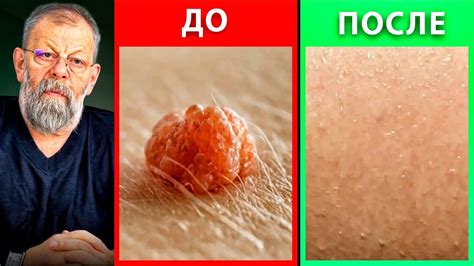 Открытие, которое изменит ваш взгляд на болезни. Как паразиты и вирусы ...
