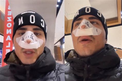 Lucky John, ecco a quali interventi si è sottoposto in Albania!