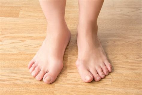 Халлюс вальгус: нужна ли операция? | MedAboutMe