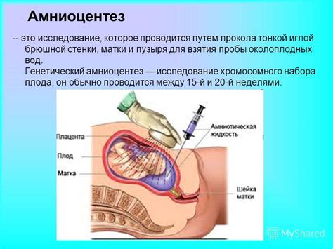 Презентация на тему: "Лекция 9 Тема: Медико-генетическое ...