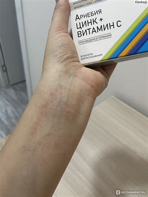 Витамины Арнебия Цинк + Витамин с - «Все хорошо, кроме побочек » | отзывы