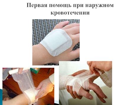 Ранения и кровотечения - презентация онлайн