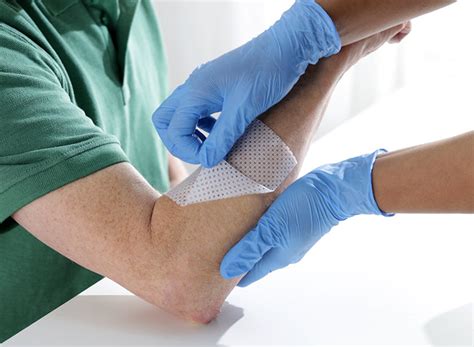 Silfix – Advancis Medical