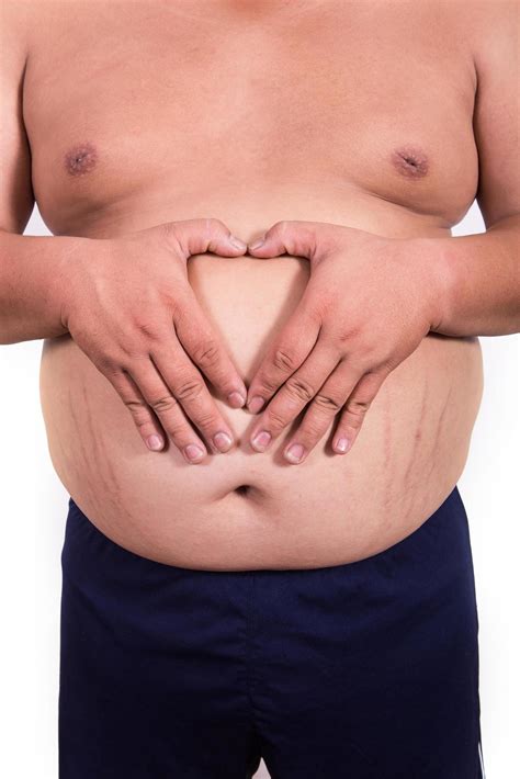 Fat man with a big belly. Diet 9565047 Stock Photo at Vecteezy
