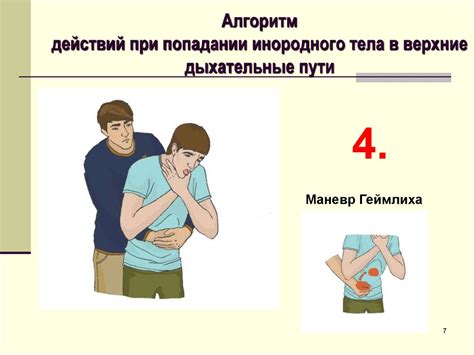 Инородные тела верхних дыхательных путей - презентация онлайн