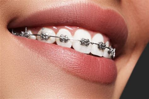 Dentist& x27; офис s стоковое фото. изображение насчитывающей посещение ...