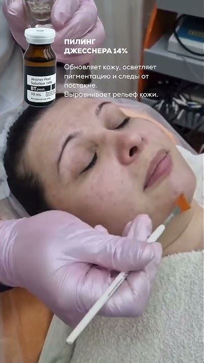 Пилинги BTpeeL - YouTube