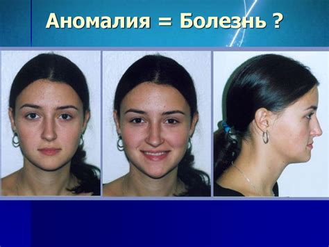 Диагностика и методы исследования в ортодонтии - презентация онлайн