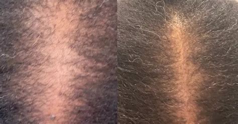 'Fantastic' organic oil 'boosts hair growth and improves skin health ...