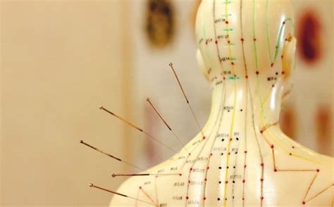Акупунктурно лечение: показания и противопоказания — Medconsult.bg