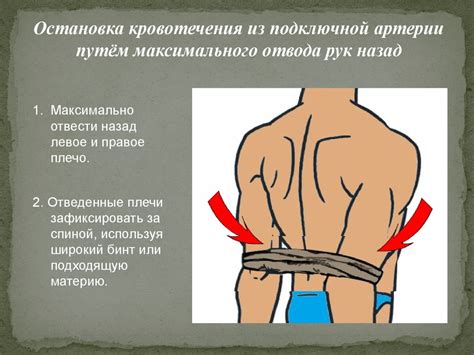 Первая медицинская помощь при ранениях - презентация онлайн