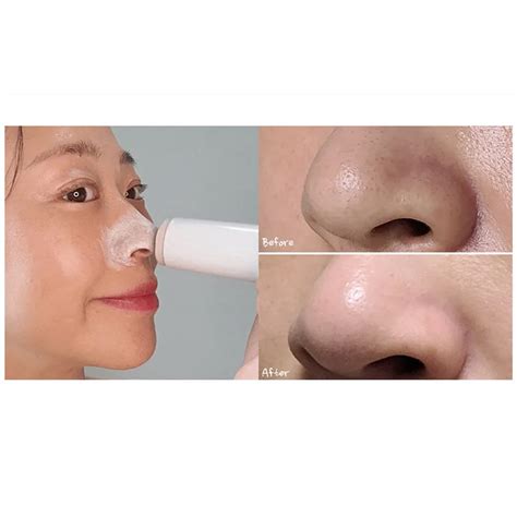 MEDI-PEEL Extra Super 9 Plus Active Stick 33g | DODO SKIN – DODOSKIN