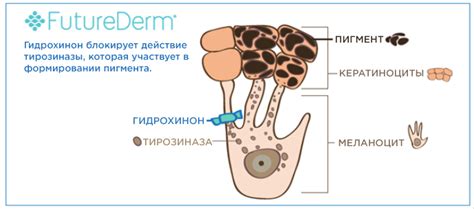 Гидрохинон от пигментных пятен: использовать или нет