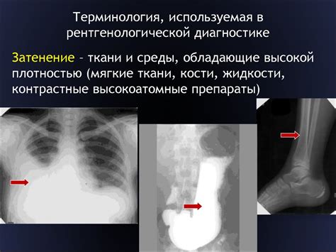 Лучевая диагностика, методы лучевого исследования - презентация онлайн