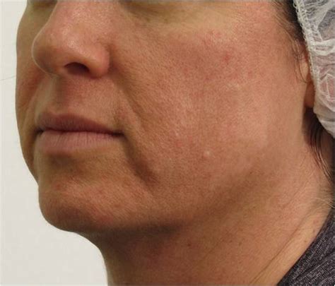 Voluderm - The Face And Body Clinic