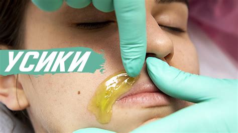 Шугаринг усиков или как правильно сделать депиляцию верхней губы ...