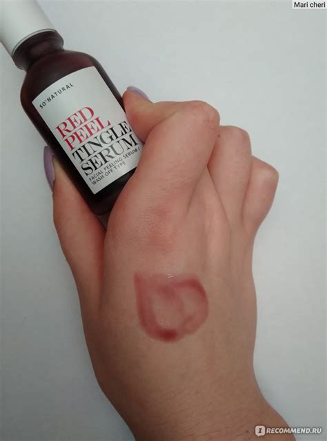 Пилинг для лица So'natural Red peel tingle serum - «Известный кровавый ...