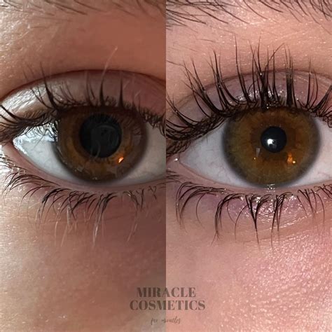 Eyelash Growth Serum – Miracle Cosmetics