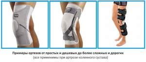 Наколенник для фиксации коленного сустава: виды, показания, выбор ...
