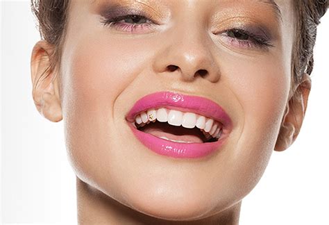 Стразы на зубах | DENTAL-INFO