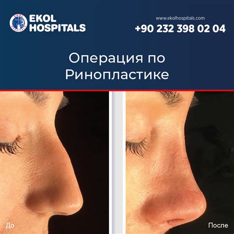 экол больницы