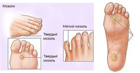 Ваши ножки будут в идеальном состоянии! | Health