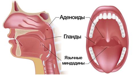 Здоровые гланды: как выглядит горло больное и здоровое