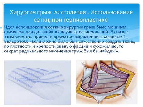 Паховая грыжа - презентация онлайн