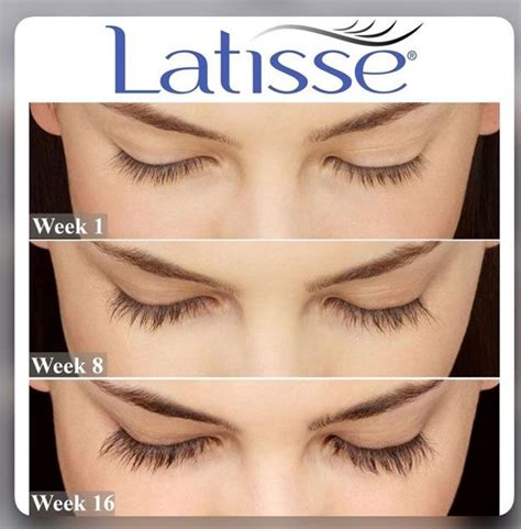 Latisse | Studio City, CA | One Body Medicine