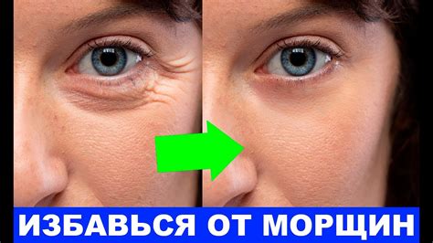 ЭФФЕКТИВНАЯ маска ПРОТИВ МОРЩИН !!! Кожа лица СТАНЕТ ГЛАДКОЙ и УПРУГОЙ ...